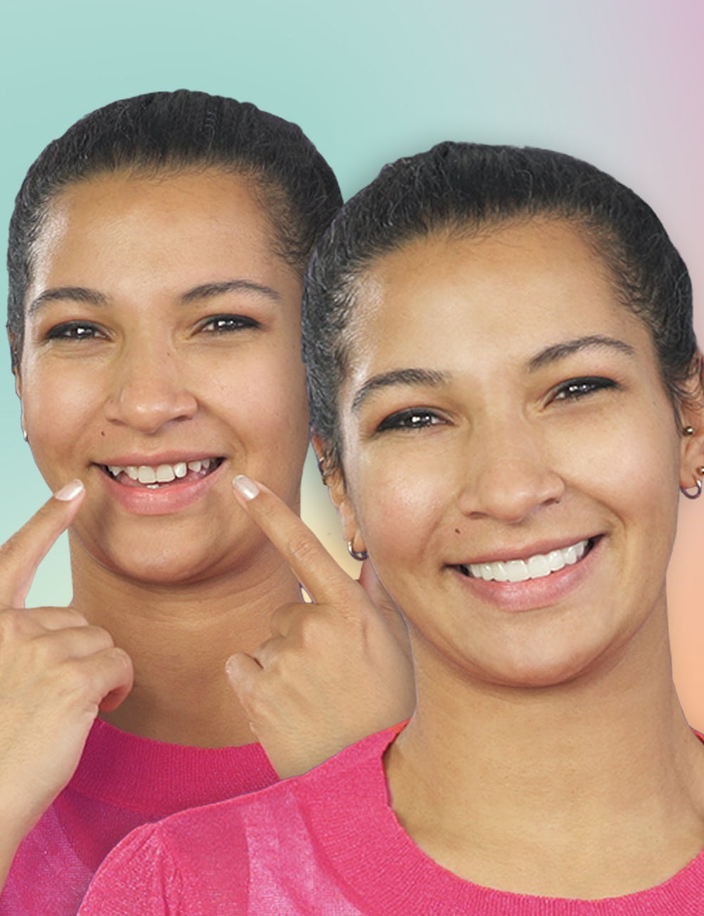 Veneera™ Teeth-Veneer | Smile just leveled up – Veneera™ UK